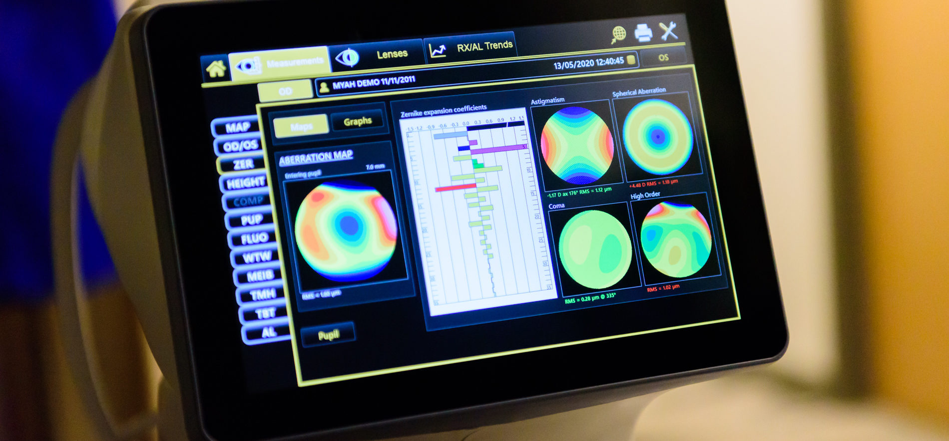 Corneal Tomography vs. Topography in Ectasia Screening | New England ...